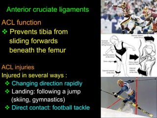 Slide for ligament injury, good for quick reference | PPT
