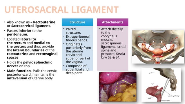 Ligaments of female genital tract .pptx