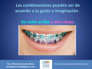 ¿Son Brackets de colores o son ligas de colores? | PPTX