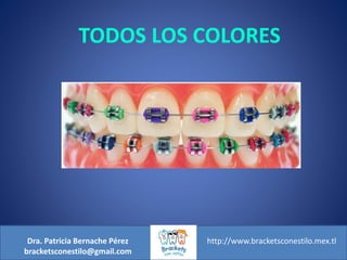 ¿Son Brackets de colores o son ligas de colores? | PPTX