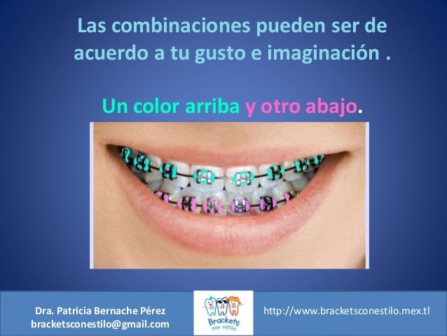 Cirujano Enlace Gracias Por Tu Ayuda Combinación De Colores En Brackets