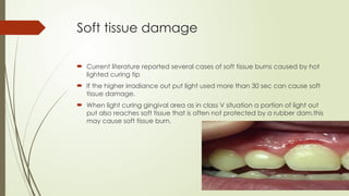 Light curing of composite meterials.pptx