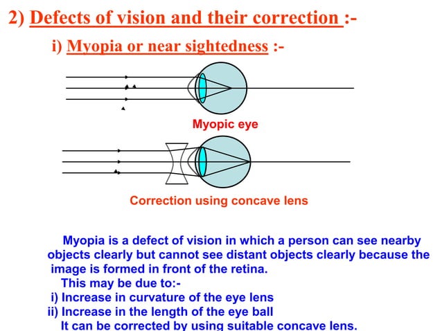 LIGHT-HUMAN EYE AND THE COLOURFUL WORLD.ppt.pptx | Eye and Vision ...