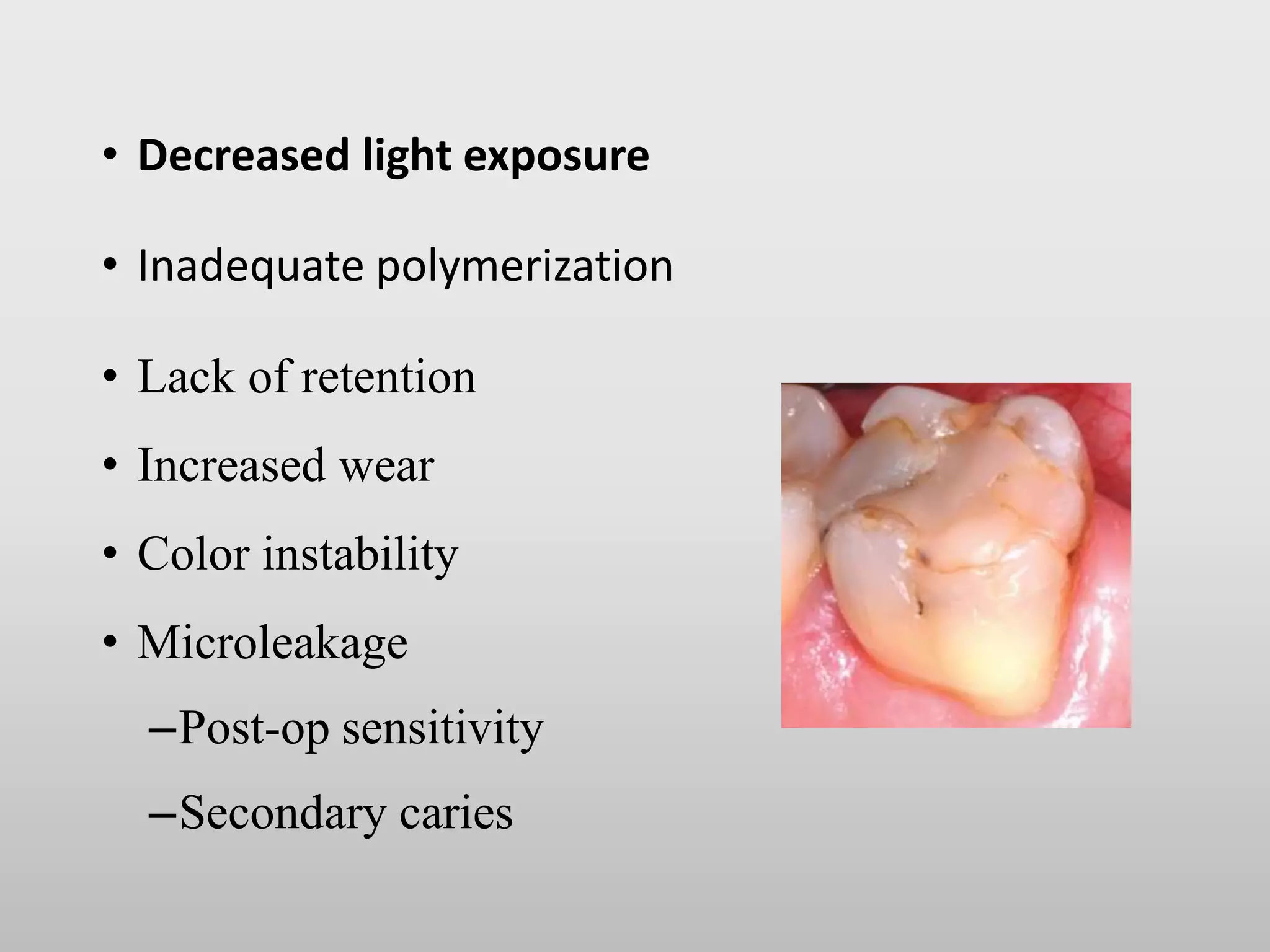 Light curing units | PPTX