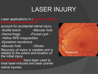 Light injury | PPTX