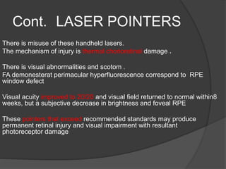 Light injury | PPT