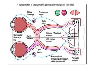Light reflex | PPTX | Eye and Vision Conditions | Diseases and Conditions