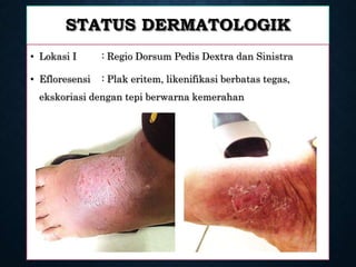 Liken_Simpleks_Kronis_LSK ( Jenerio P).pptx