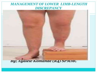 LIMB-LENGTH DISCREPANCY.pptx