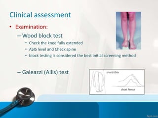 Limb length discrepancy evaluation | PPTX