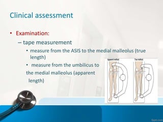Limb length discrepancy evaluation | PPTX