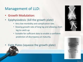 Limb length discrepancy evaluation | PPTX