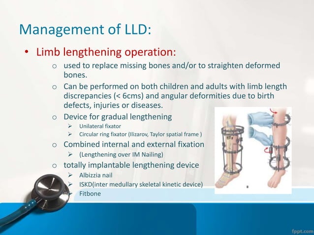 Limb length discrepancy evaluation | PPTX | Physical Therapy | Wellness