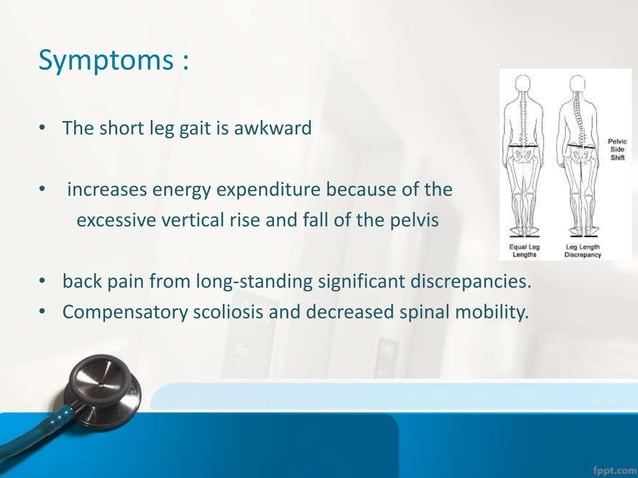 Limb length discrepancy evaluation | PPTX | Physical Therapy | Wellness