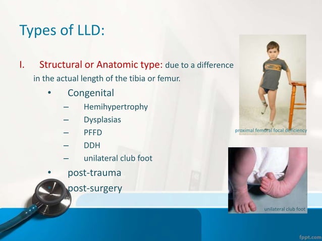 Limb length discrepancy evaluation | PPTX | Physical Therapy | Wellness