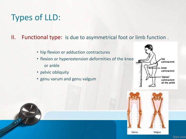 Limb length discrepancy evaluation | PPTX | Physical Therapy | Wellness