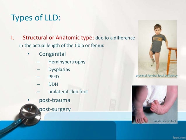 Limb length discrepancy evaluation