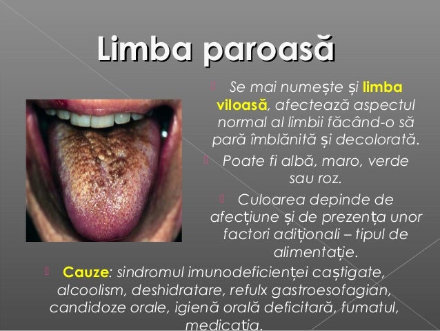 Limba