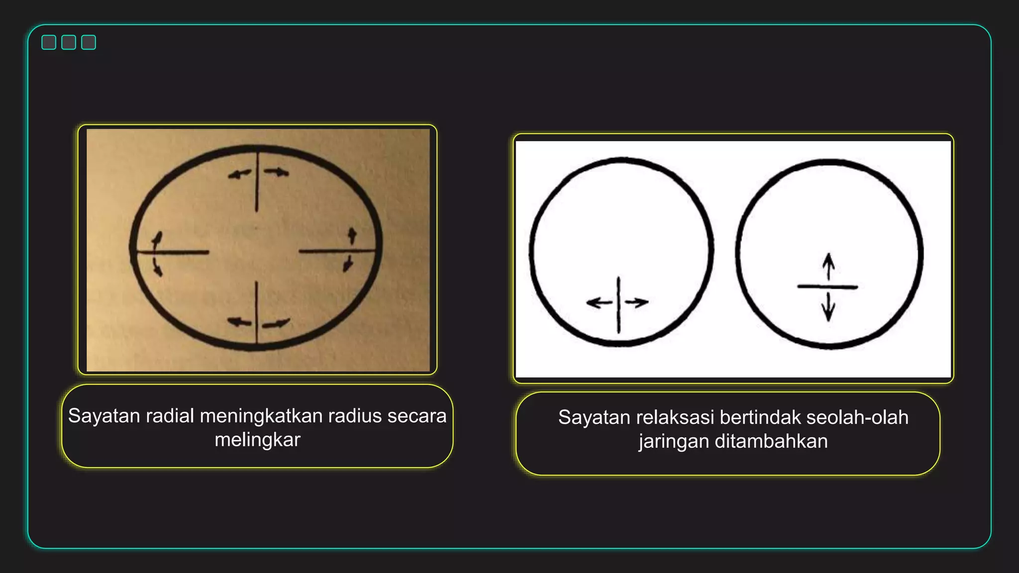 Limbal Relaxing Incisions fix2.pptx