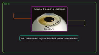 Limbal Relaxing Incisions fix2.pptx