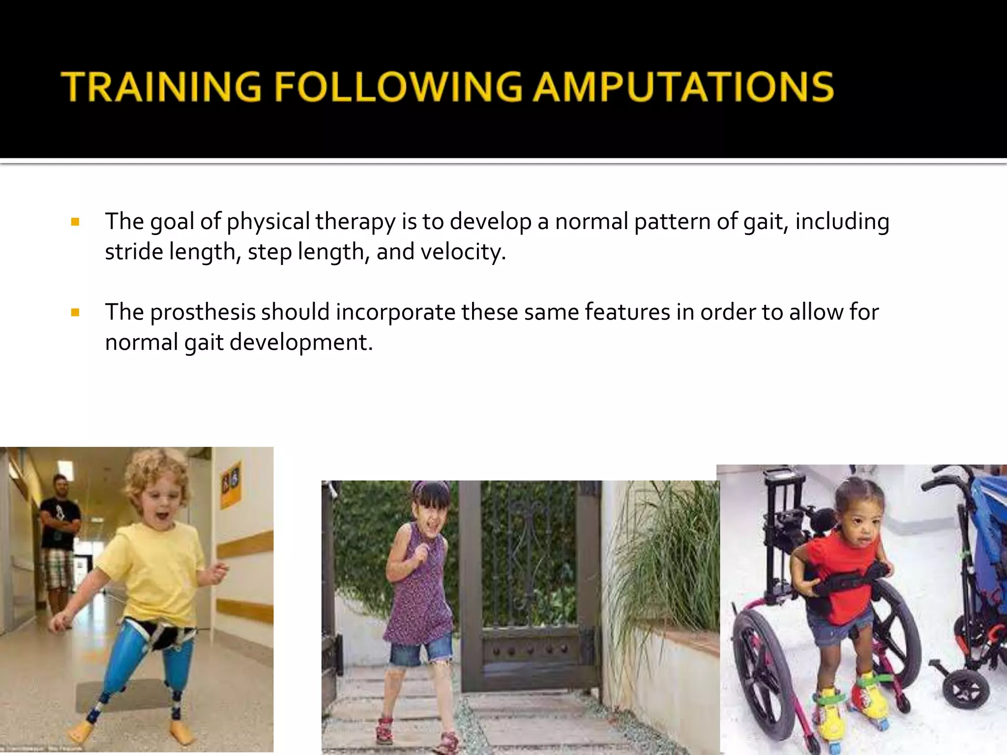 Limb deficiencies and amputations | PPTX