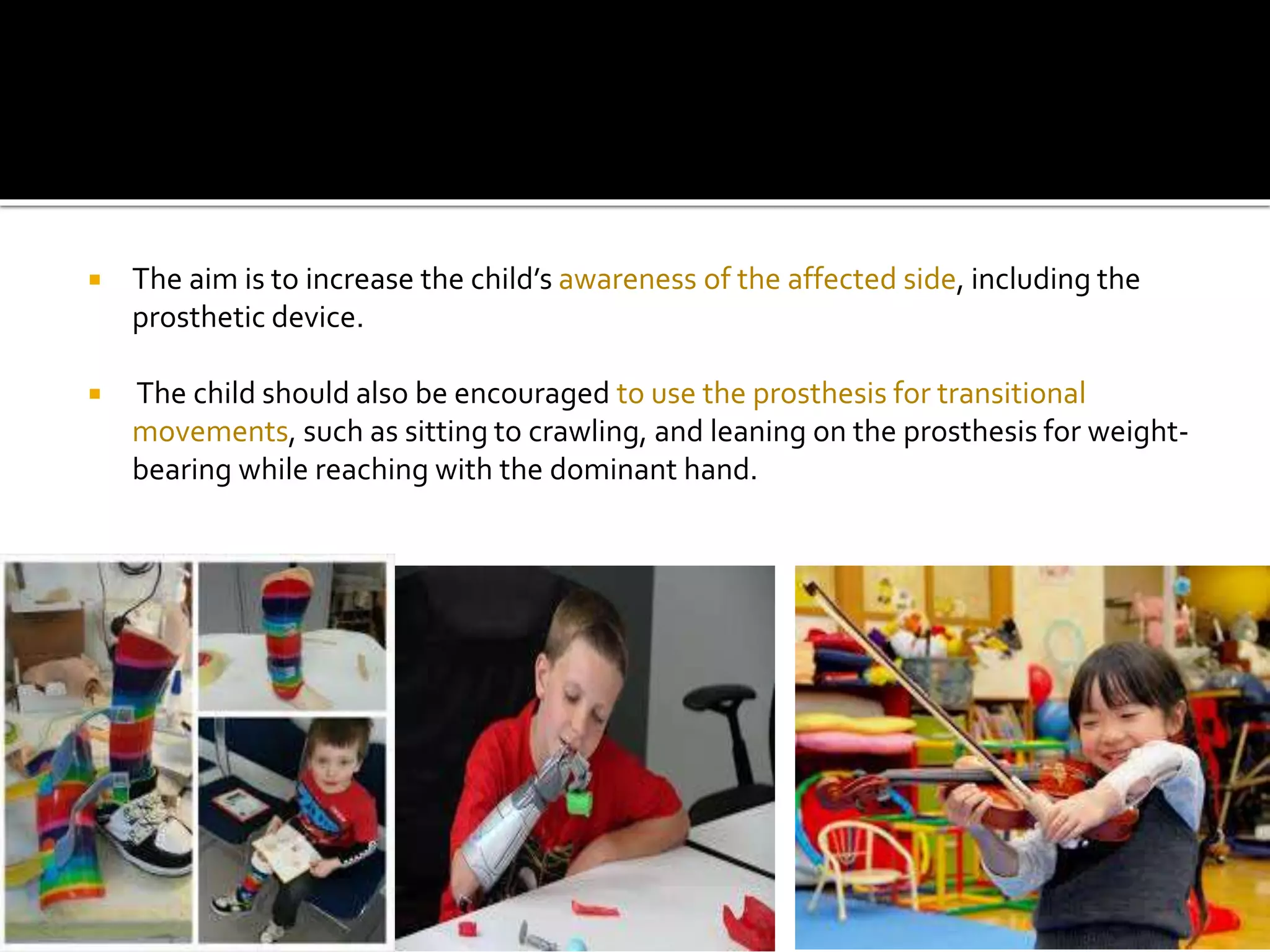 Limb deficiencies and amputations | PPTX