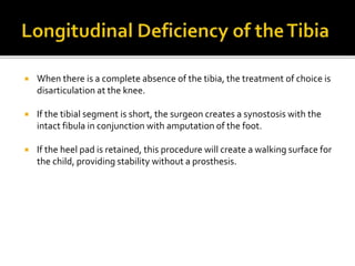 Limb deficiencies and amputations | PPTX