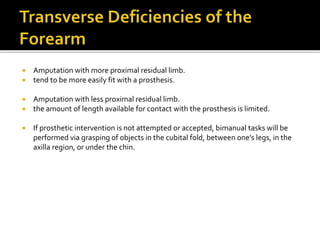 Limb deficiencies and amputations | PPTX
