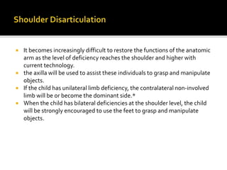 Limb deficiencies and amputations | PPTX