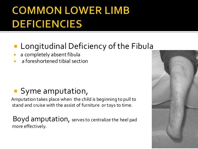 Limb deficiencies and amputations