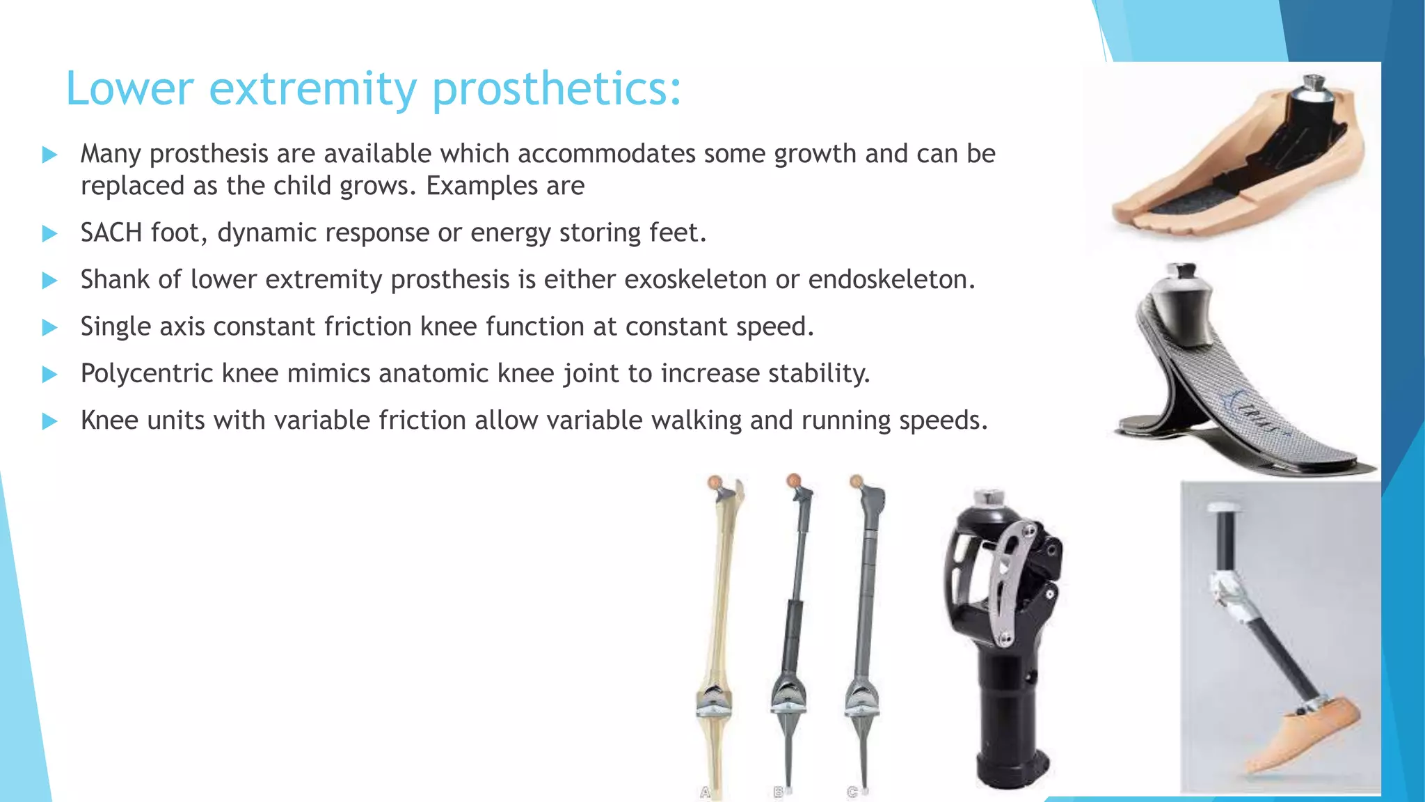 Limb deficiencies and amputations | PPTX