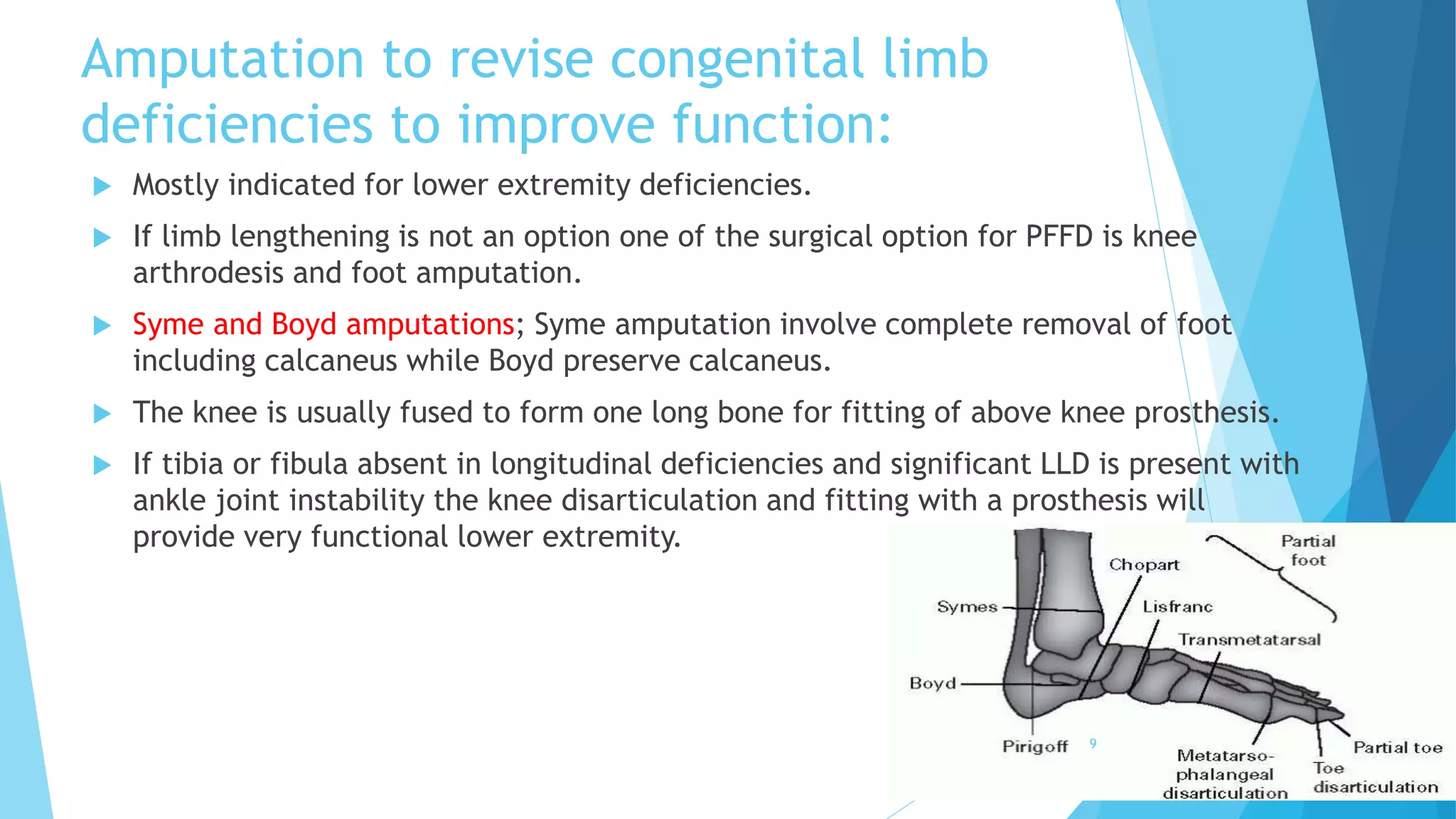 Limb deficiencies and amputations | PPTX