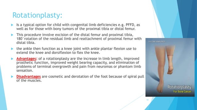 Limb deficiencies and amputations | PPTX | Foot Health | Diseases and ...