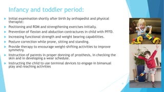 Limb deficiencies and amputations | PPTX