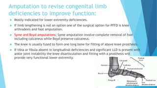 Limb deficiencies and amputations | PPTX