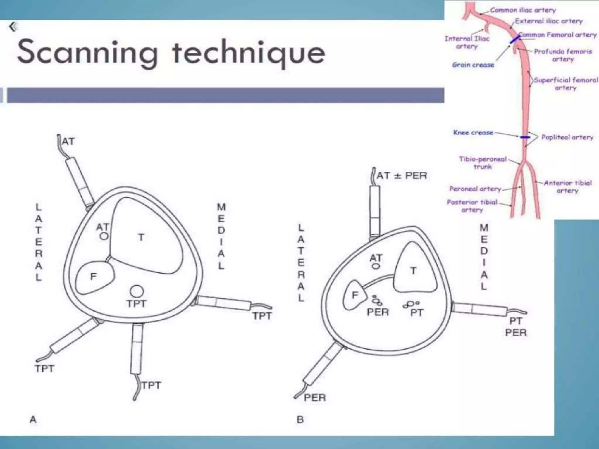 limb doppler ppt .ppt