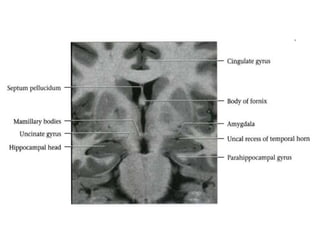 Limbic System Anatomy Mri