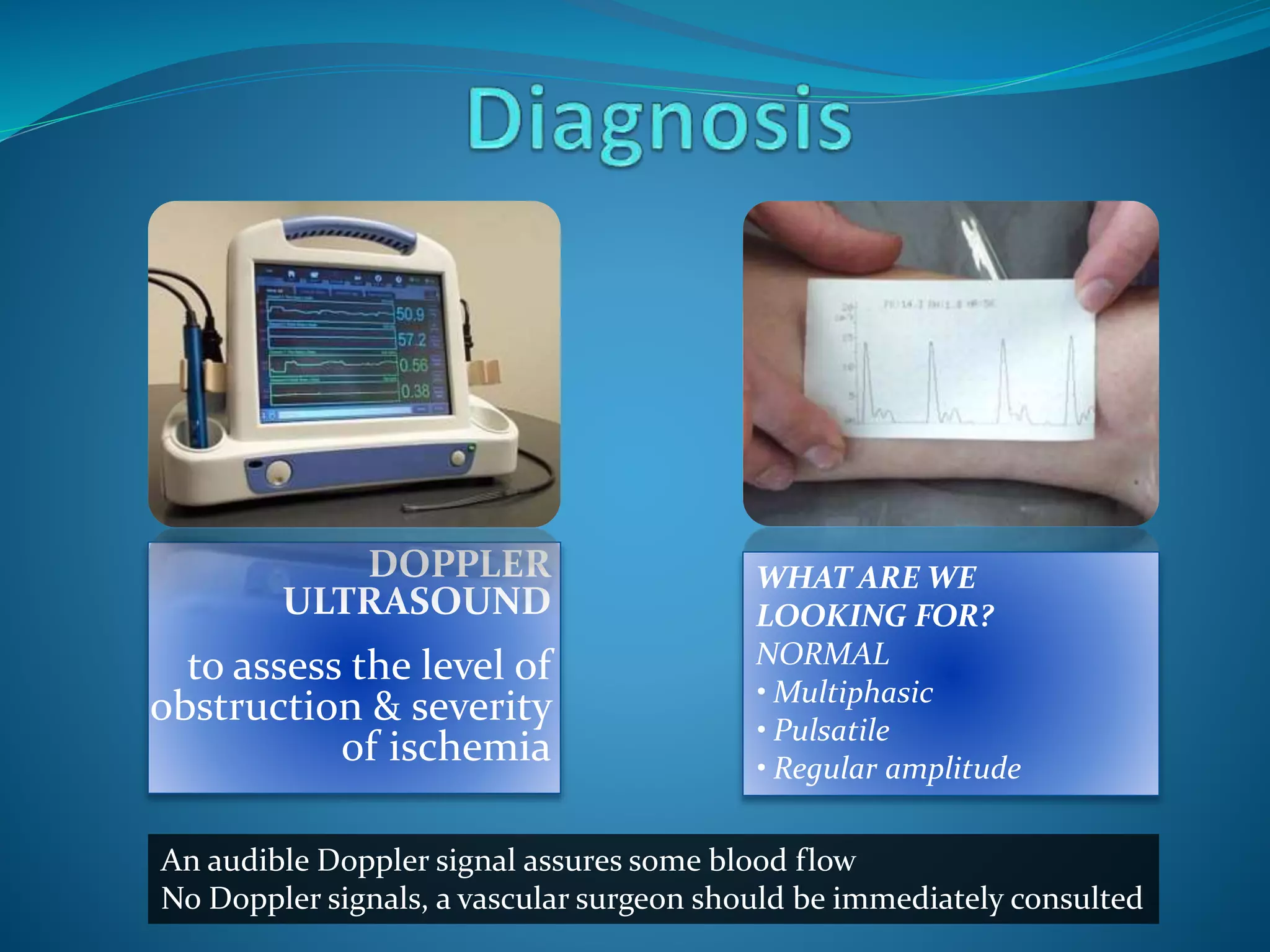 LIMB ISCHEMIA-ACUTE.pptx