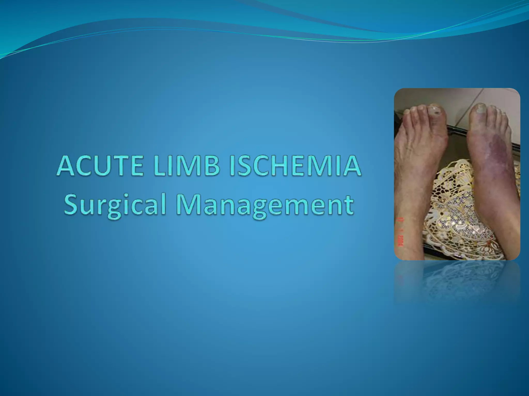 LIMB ISCHEMIA-ACUTE.pptx