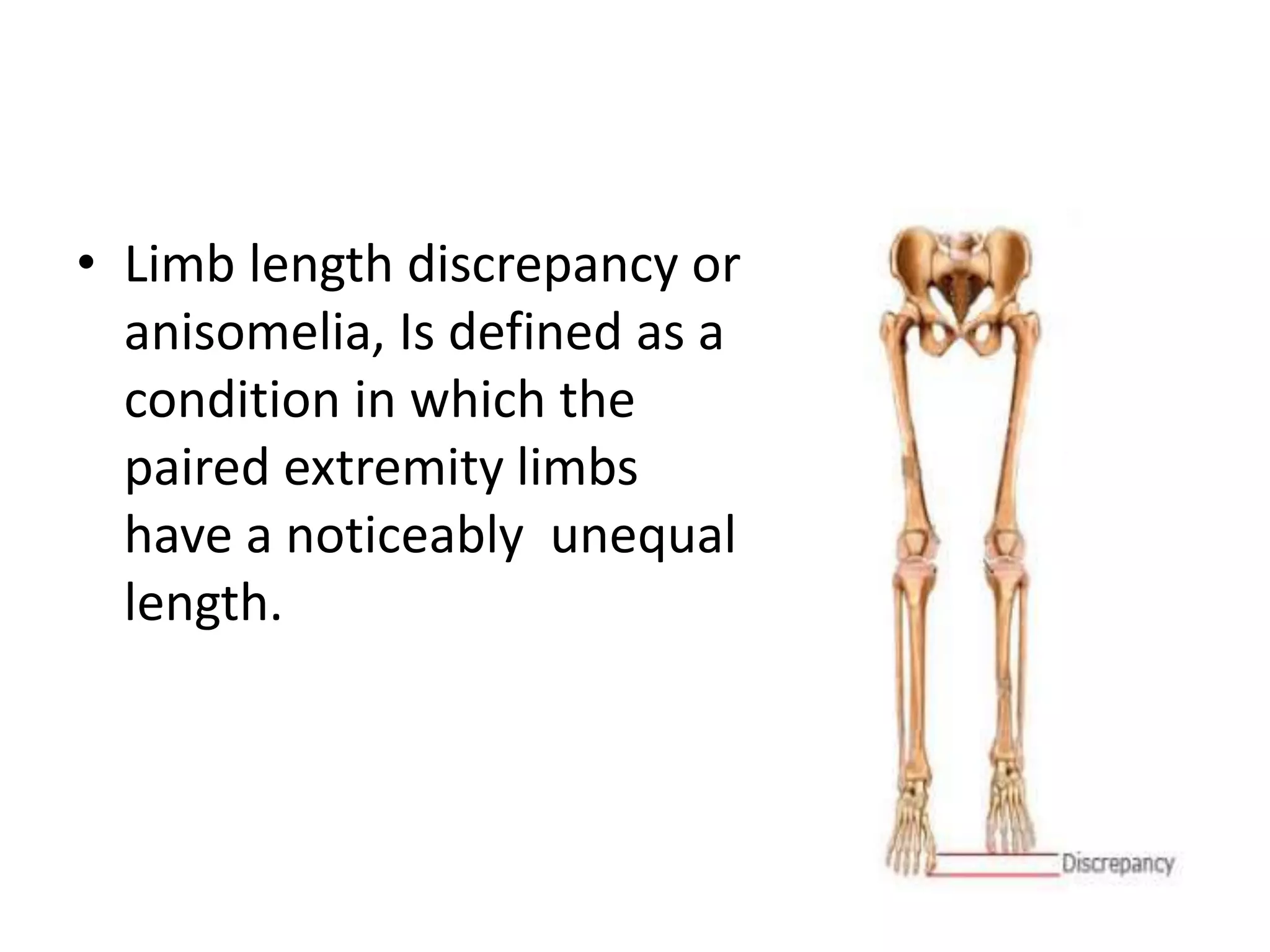 Limb length discrepancy | PPT
