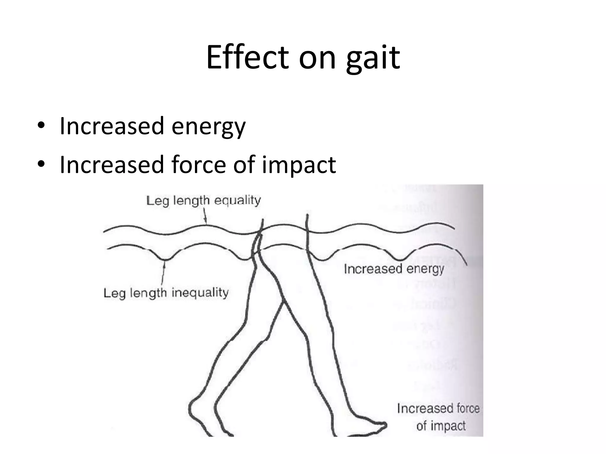 Limb length discrepancy | PPT