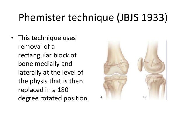 Limb length discrepancy