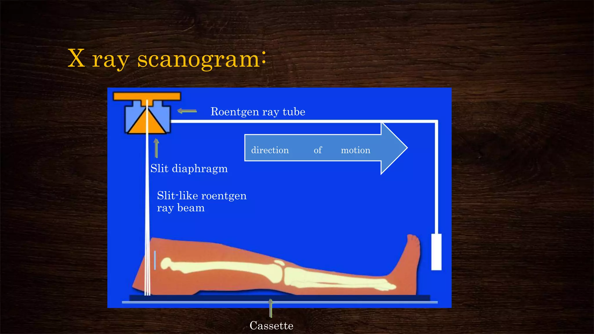 Limb length discrepancy | PPTX