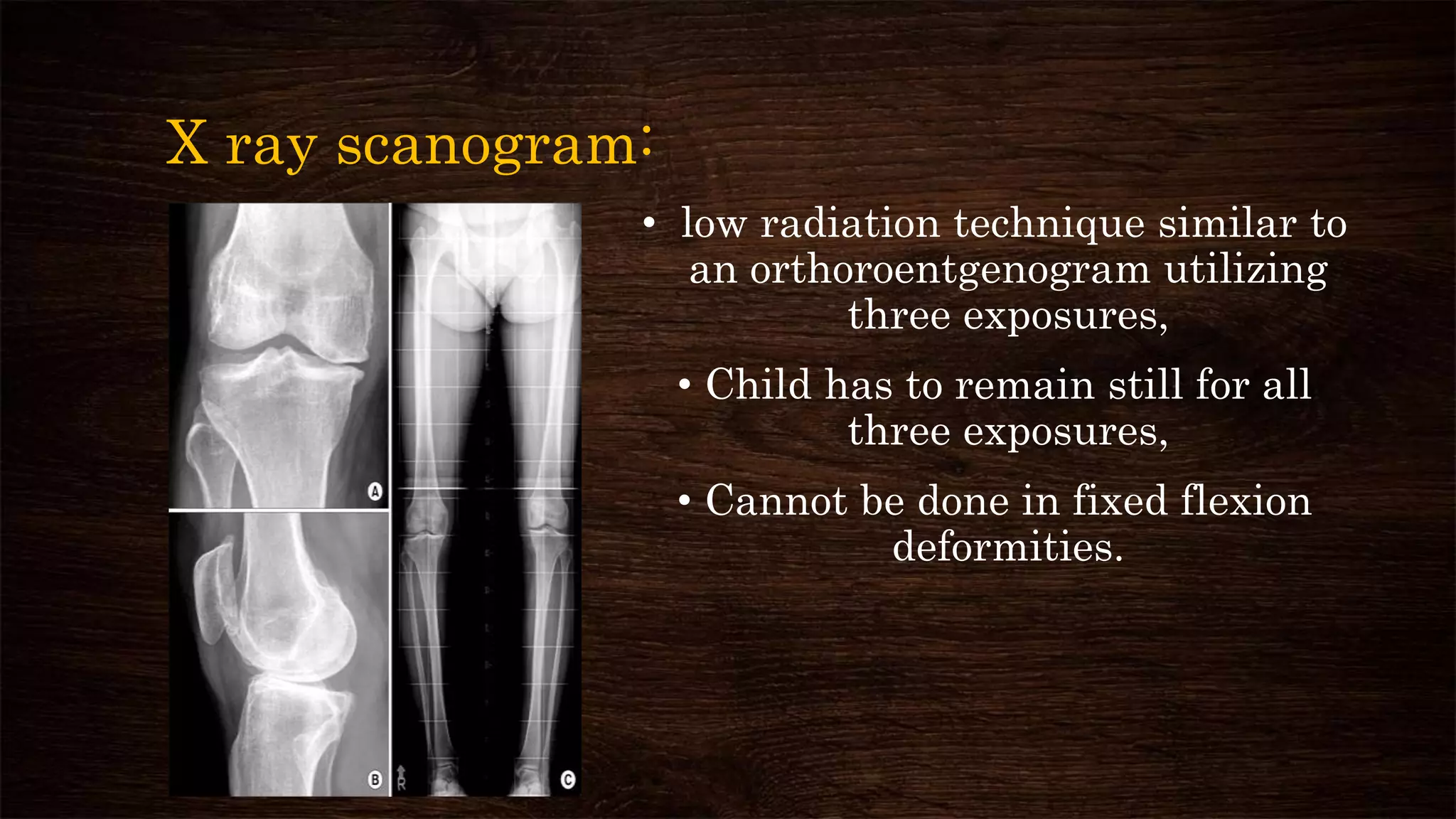 Limb length discrepancy | PPTX