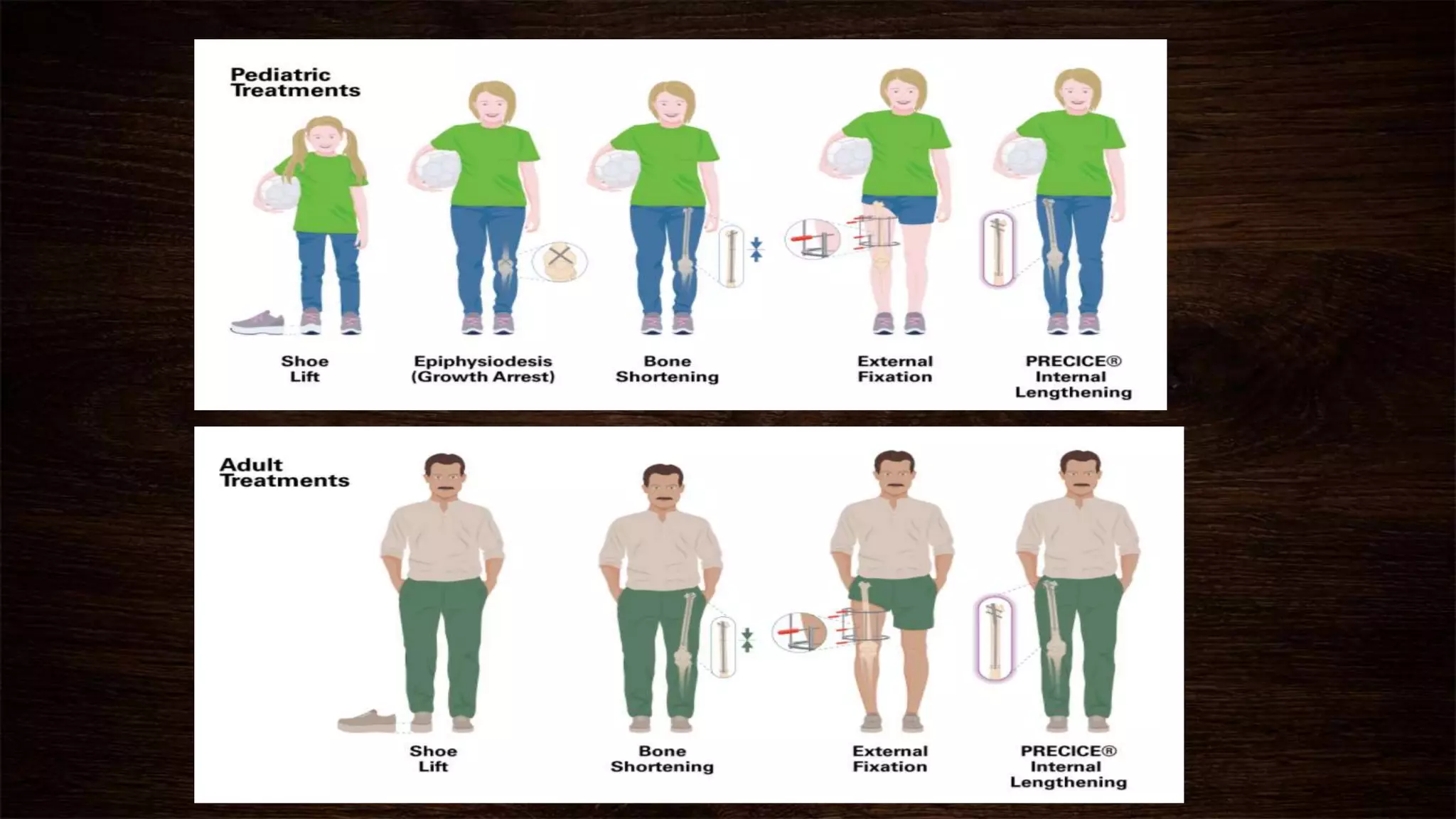 Limb length discrepancy | PPTX