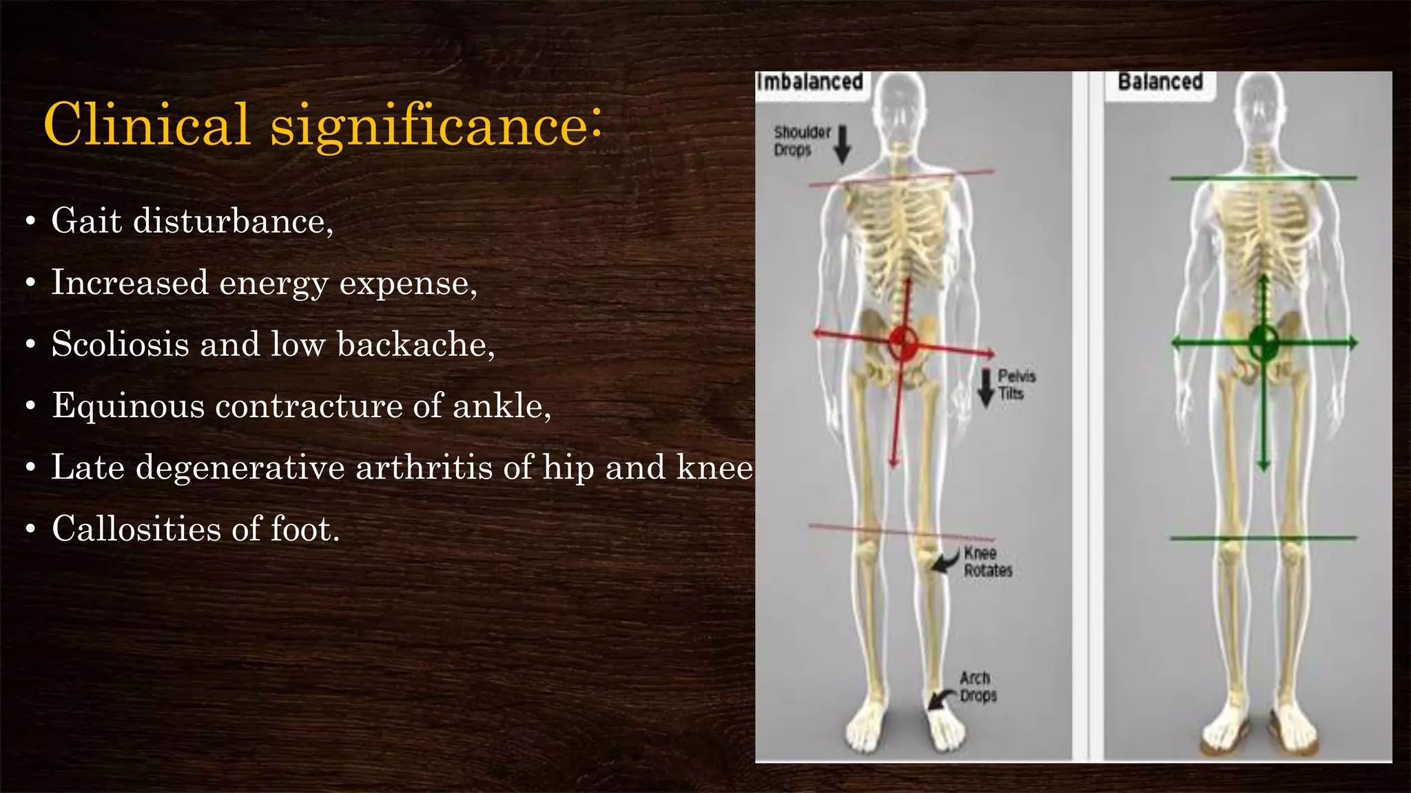 Limb length discrepancy | PPTX