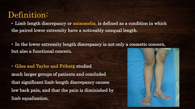 Limb length discrepancy | PPTX | Death, Injury, or Military Conflict | Sensitive Topics
