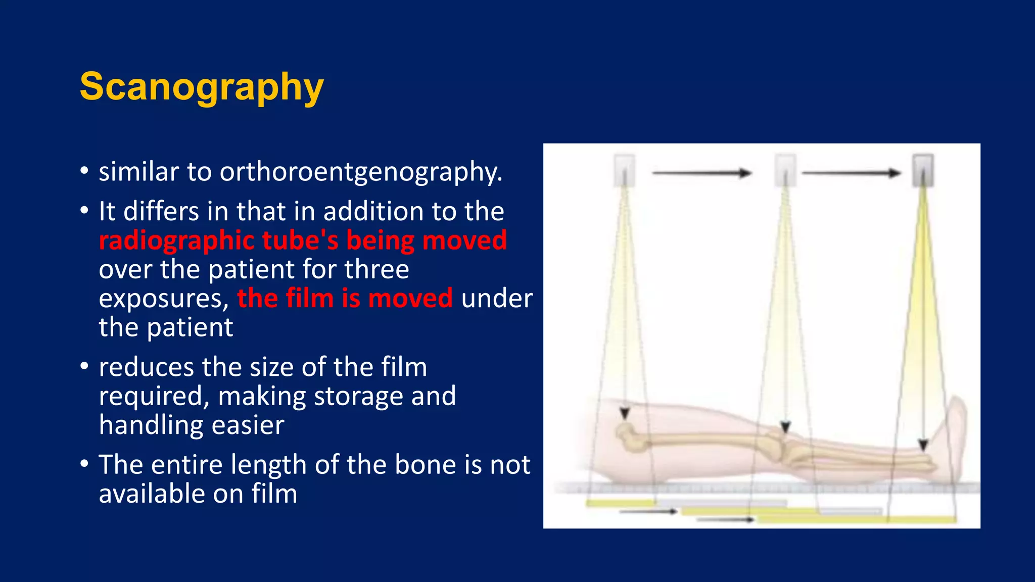 Limb length discrepancy | PPTX