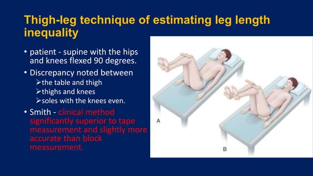 Limb length discrepancy | PPTX