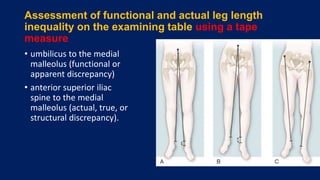 True Leg Length Discrepancy Test